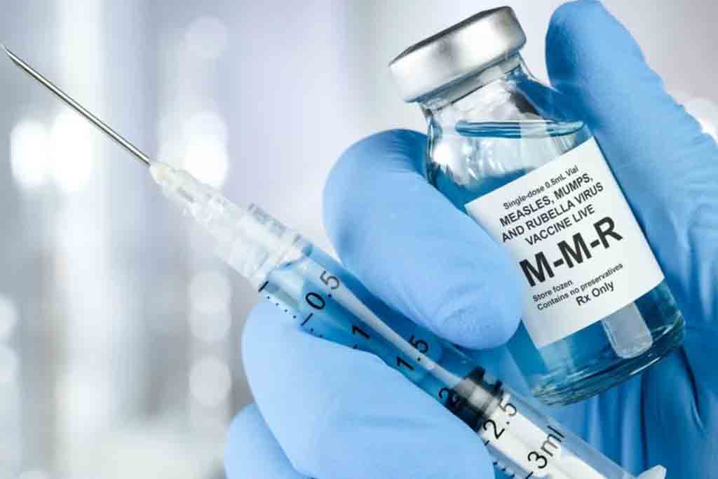 SL reports measles cases surge in 09 districts - LNW Lanka News Web